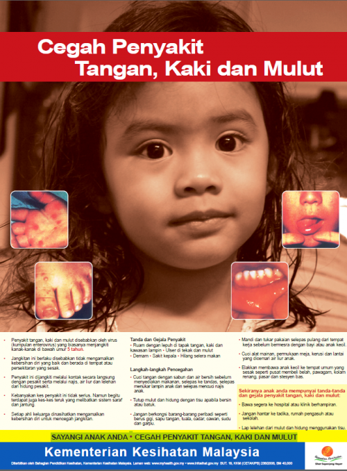 AWAS! HFMD:Cegah Penyakit Tangan, Kaki dan Mulut - GREENIEKIDS